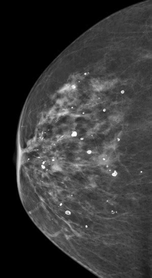 Penang Breastcare Hub