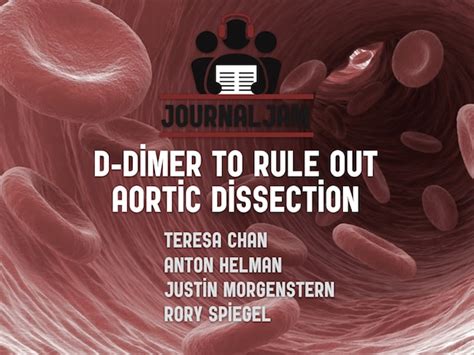 D Dimer Rule Out Aortic Dissection Em Cases Journal Jam Podcast