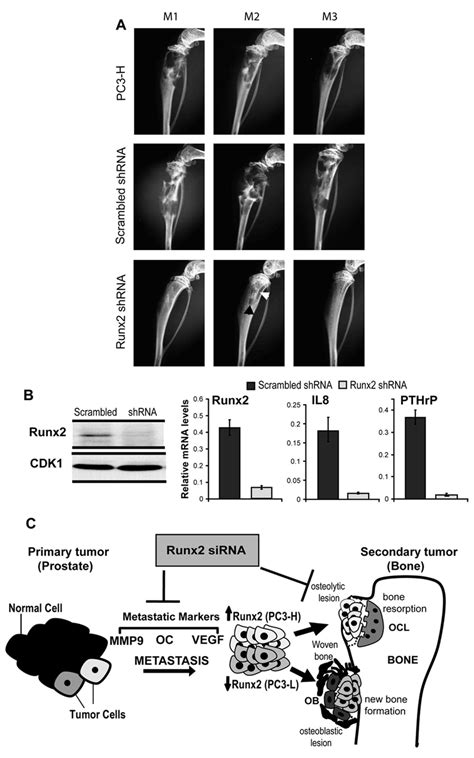 Runx Knockdown Reduces Metastatic Bone Disease Download Scientific Diagram