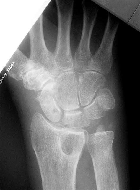 Ucsd Musculoskeletal Radiology