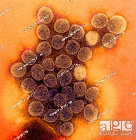 Transmission Electron Micrograph Of A Variant Strain Of Sars Cov 2 Virus Particles Uk B Stock
