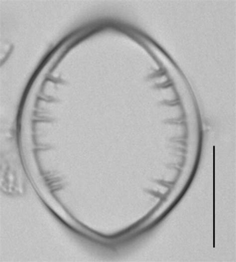 Compare Cocconeis Placentula Species Diatoms Of North America