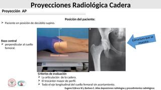 Rx Pelvis Y Cadera Para Presentar Ya Listo Pptx