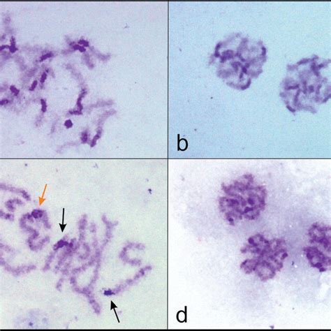 A Bn Bozdagus With Dark Heterochromatic Blocks On All Chromosomes A