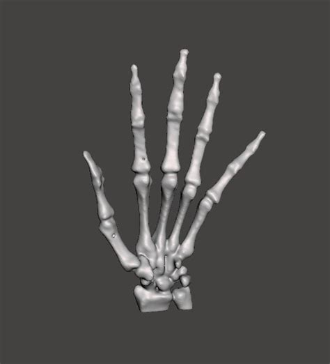 Stl File Hand Medical Bone From Segmentation ・3d Print Design To