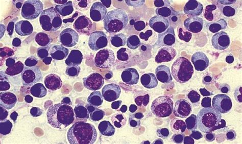 Células Plasmáticas Archivos Tipos De Celulas