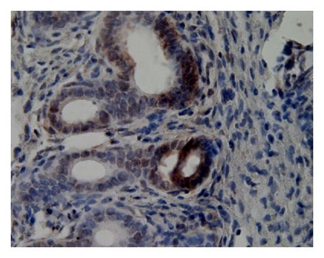 The Expression Of Erα In Eutopic Endometrium Dab Stain ×400 A