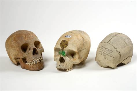 Bones In Auctiona History Of Creating Acquiring And Selling Human