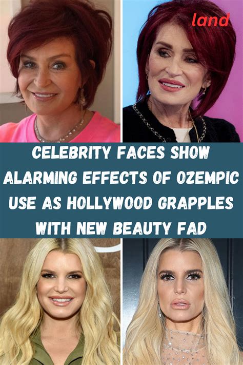 Celebrity Faces Show Alarming Effects Of Ozempic Use As Hollywood