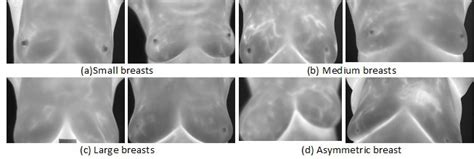 Different Cases Segmentation Results Download Scientific Diagram
