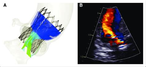 Representation Of The Computational Fluid Dynamics Simulation A The Download Scientific