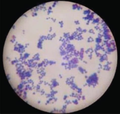 Gram Stain Gram Positive Cocci In Clusters Nzhgk