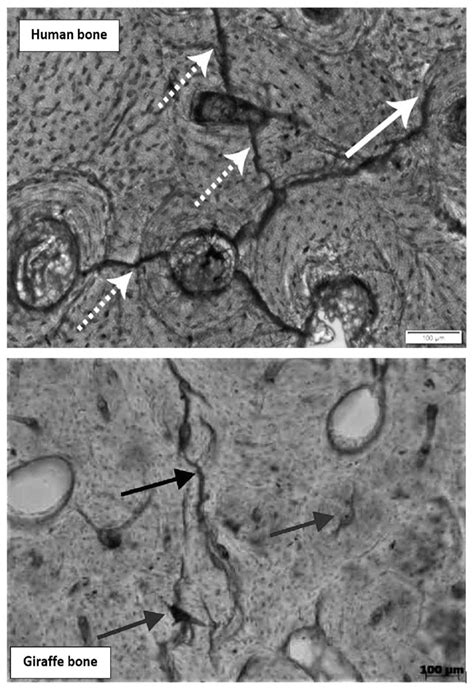 Lightning Strikes Carve A Deadly Signature Deep Inside The Bones Scientists Discover ScienceAlert