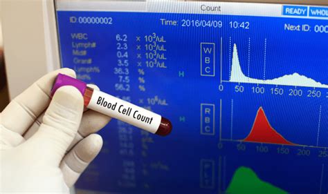 The Complete Guide To Common Hematology Tests An Overview Vaidam Health