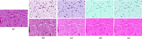 each column shows color deconvolution results by different methods in