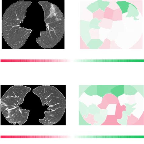 Overview Of Our Proposed Xai Model For Explainable Segmentation Here