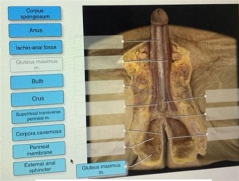 Label The Male Perineum Using The Hints Provided Learnexams