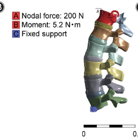 A Spinal Protection Device B Simulation Diagram Of A Person Download Scientific Diagram
