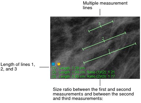 Measuring Straight Lines