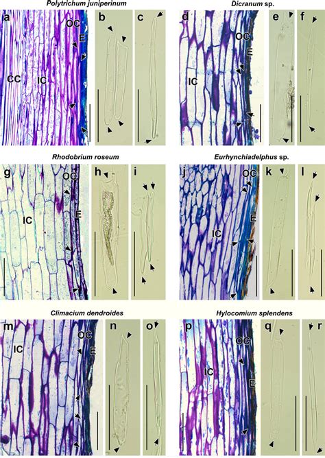 Longitudinal Section Of Stems A D G J M P And Elongated Cells