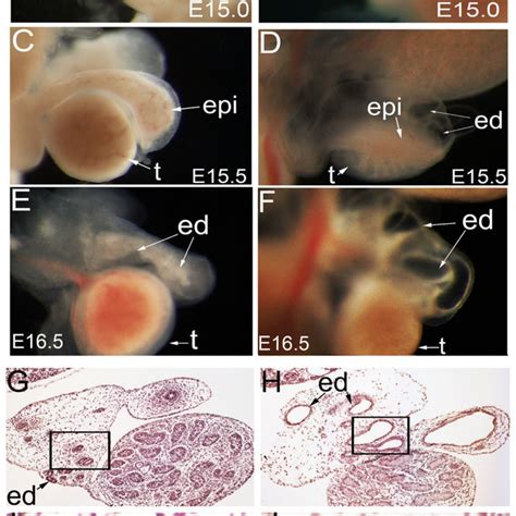 Epididymis Defects In Pkd1 Mice A B Lacz Staining Of E165 Male