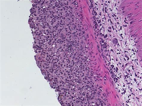 Dss Induced Colitis Model Smc Laboratories Inc