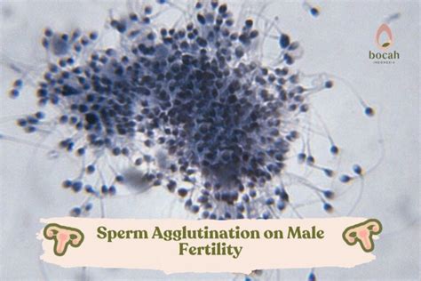 Sperm Agglutination On Male Fertility