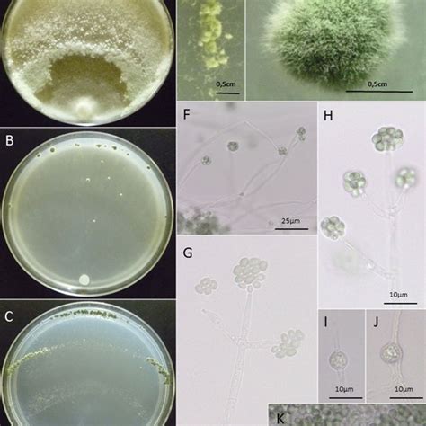 Morphological Characteristics Of Trichoderma Texanum Ac Cultures On
