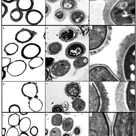 Transmission Electron Microscopy Of Cultured Cryptococcus Neoformans