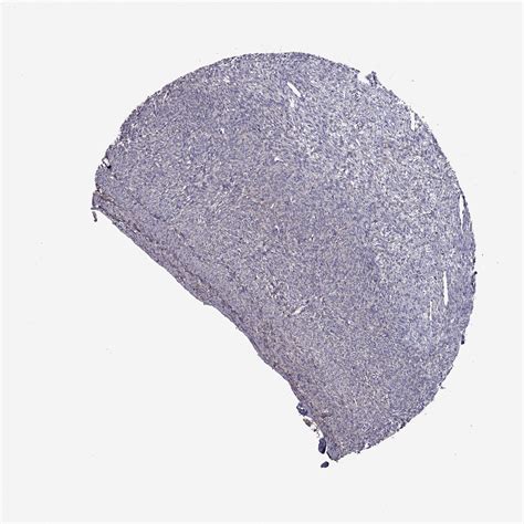 Tissue Expression Of Itgb1 Staining In Ovary The Human Protein Atlas