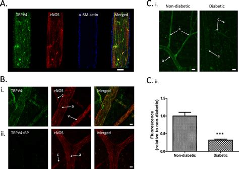 Vascular Trpv4 Expression Is Downregulated In Diabetic Rats A