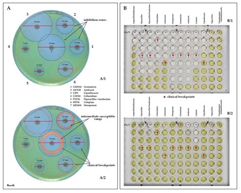 Pseudomonas Aeruginosa Habitat Diagnosis Pathogenesis Treatment