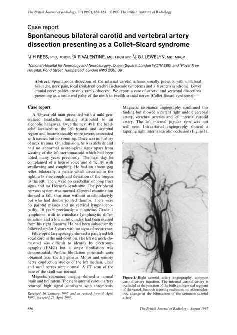 Pdf Spontaneous Bilateral Carotid And Vertebral Artery Dissection