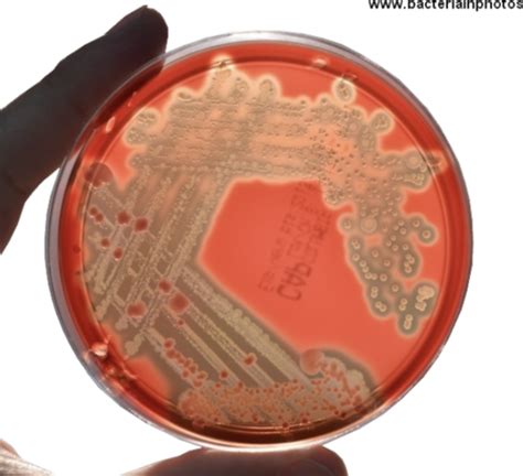 Beta Hemolytic Streptococci Laboratory Flashcards Quizlet