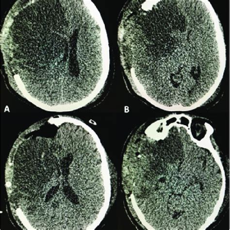 Icp Waveform The Peaks Shown P1 P2 And P3 May Be Considered To Be Download Scientific Icp Waveform The Peaks Shown P1 P2 And P3 May Be Considered To Be Download Scientific