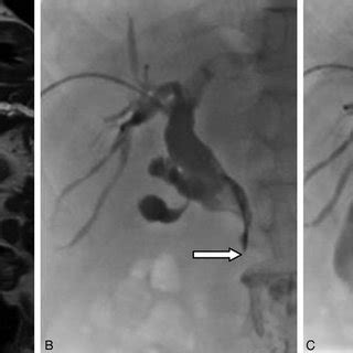 The Preoperative Imaging Examinations And Intraoperative Download Scientific Diagram