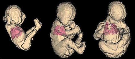 3d Mr Reconstructions Of T2 Weighted Ssfse Sequences Tr Indefinite Te Download Scientific
