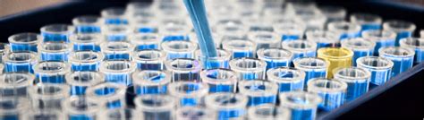 Difference Between Antibody Specificity And Selectivity Aeonian Biotech