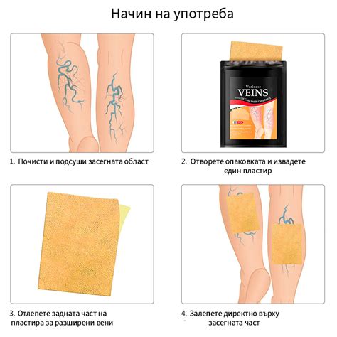 【Пластири за разширени вени】 Комплект от 12 броя