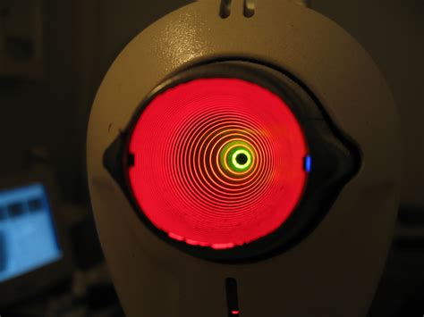 Filecomputerised Corneal Topography Wikimedia Commons