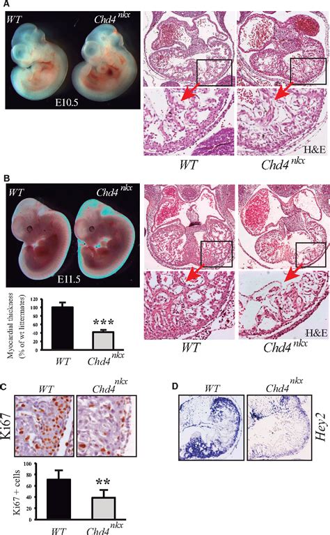 Figure 1 From The Chromatin Remodeling Complex Chd4 Nurd Controls Striated Muscle Identity And