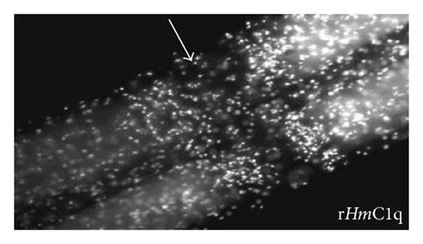 Chemotactic Effect Of Recombinant Hmc1q On Leech Microglia In Isolated