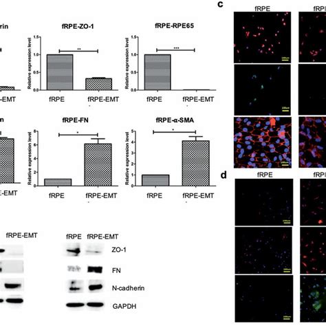 expression of rpe specific markers and mesenchymal markers emt in