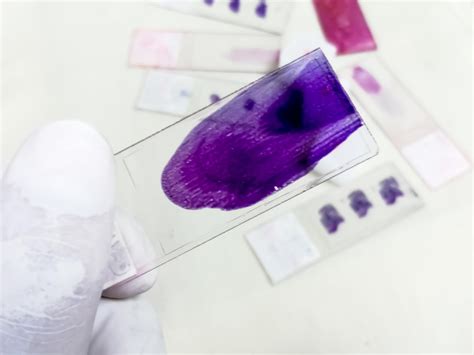 Standardizing Immunohistochemistry Staining Processes The Crucial Role