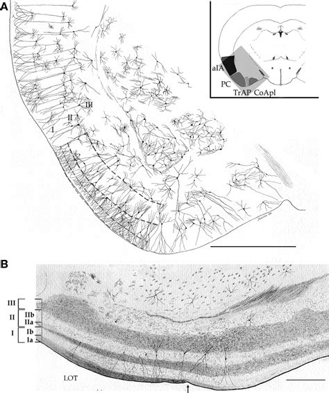 Piriform Cortex