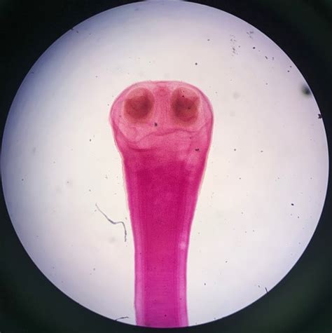 Cestodes Flashcards Quizlet