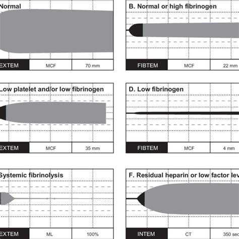Reference Normal Ranges For Rotem S And Teg S Tests Download Table