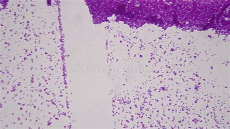 Se Filman Bajo Microscopio Tres Tipos De Bacterias Contra Campo