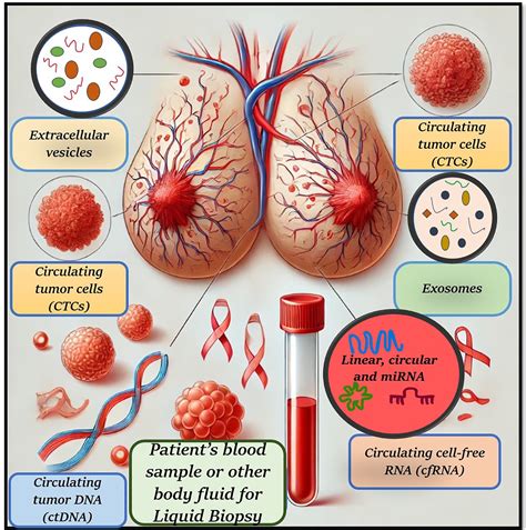 The Impact Of Liquid Biopsy In Breast Cancer Redefining The Landscape