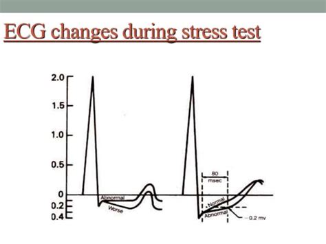 TREADMILL TESTING PPTX Heart And Cardiovascular Diseases Diseases And Conditions